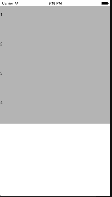 React-Native Animated ScrollView Row Swipe Actions